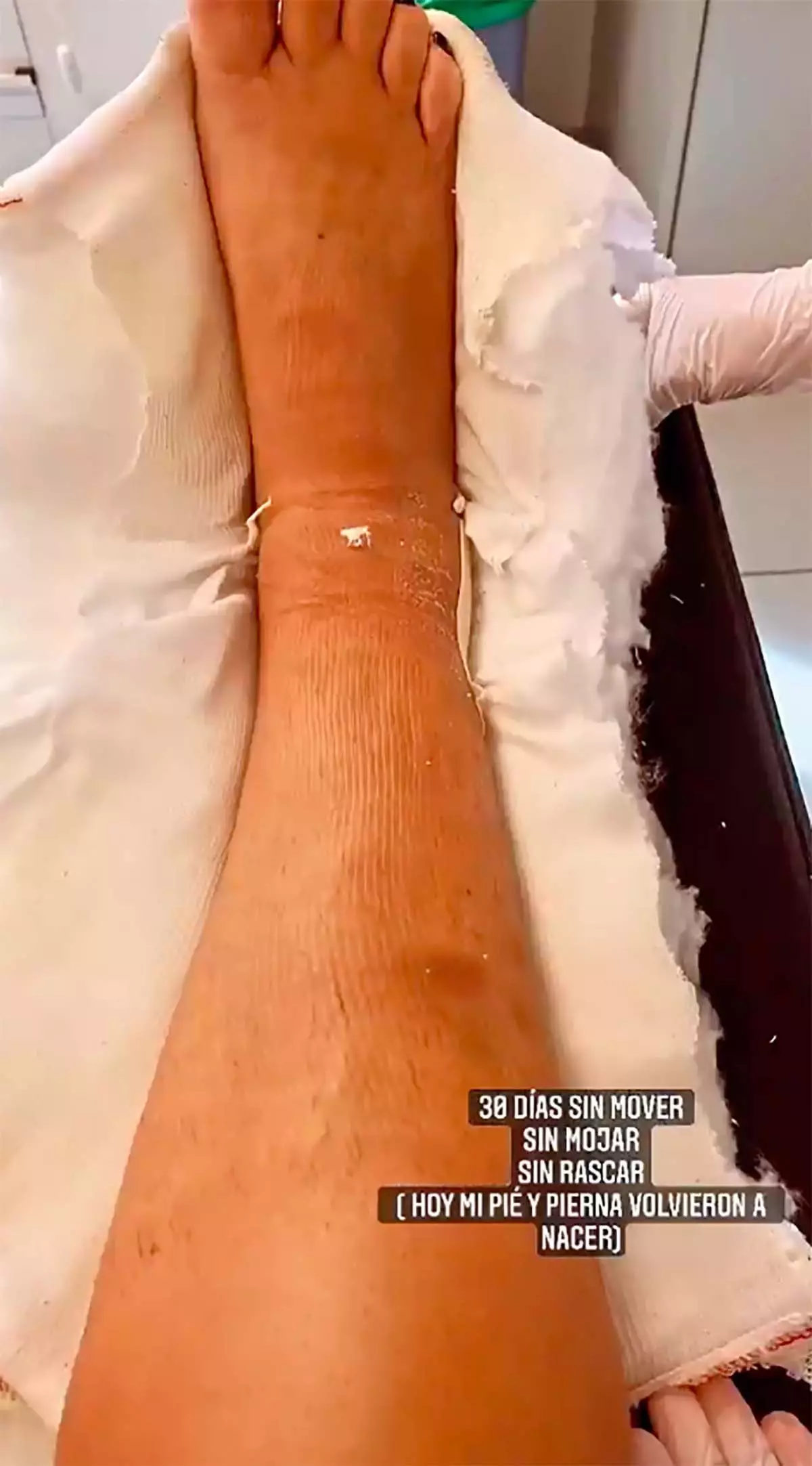 anabel pantoja gips