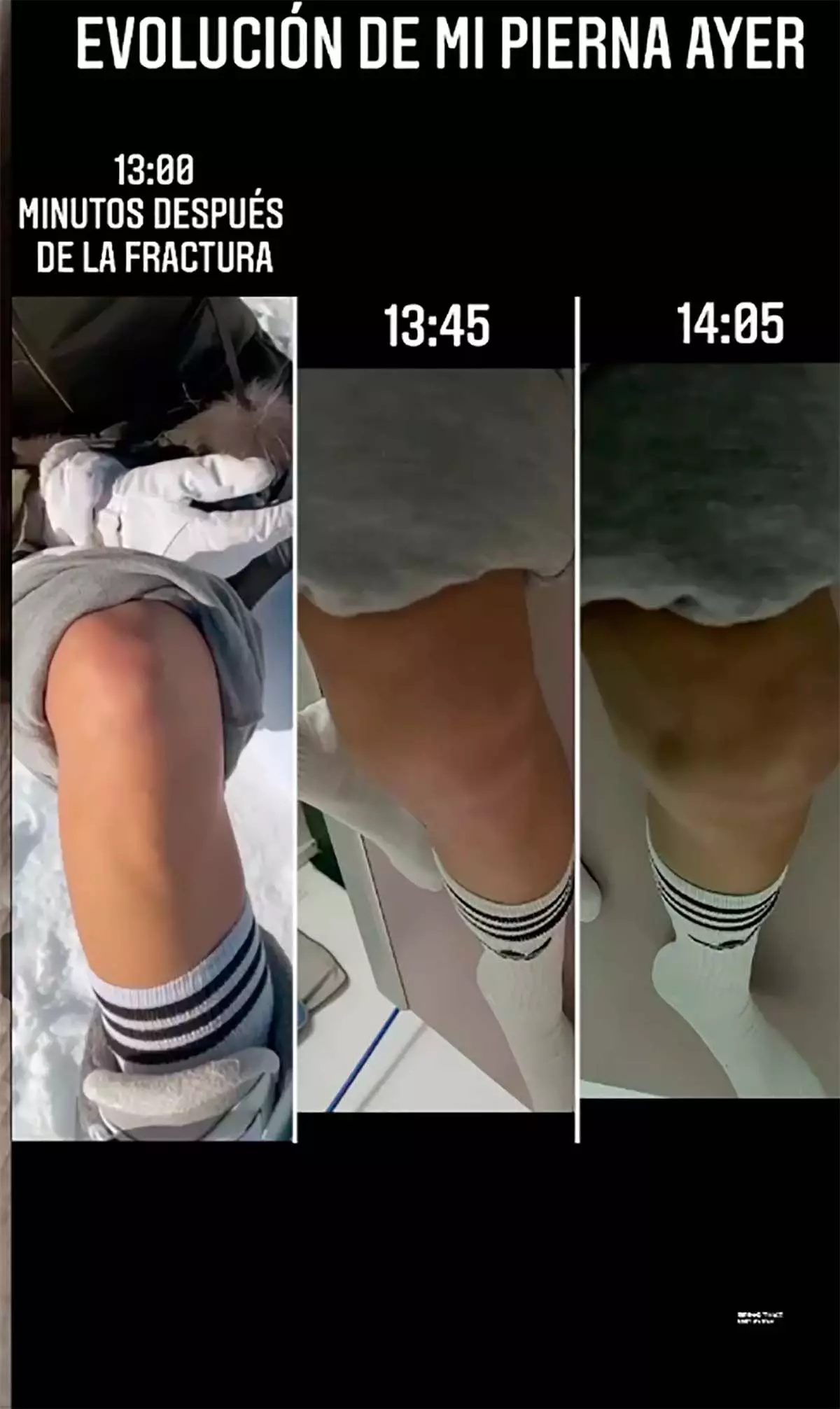 carla barber leg