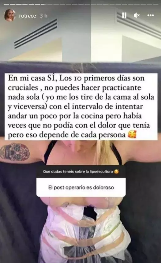 Rocío Flores montras la rezulton post sia liposkulpta operacio