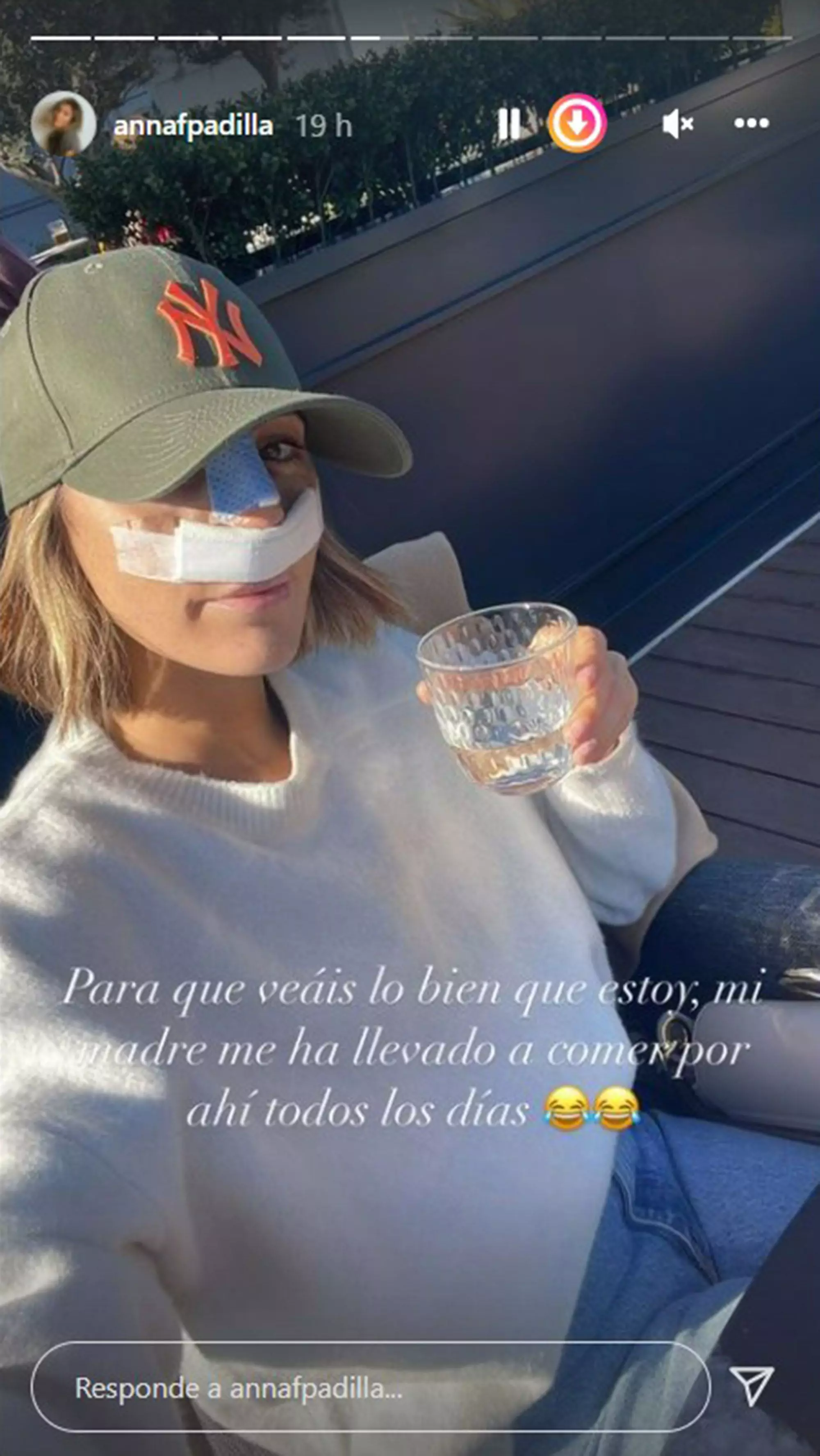 أعلنت آنا فيرير باديلا ، ابنة باديلا ، أنها خضعت لعملية تجميل أنف