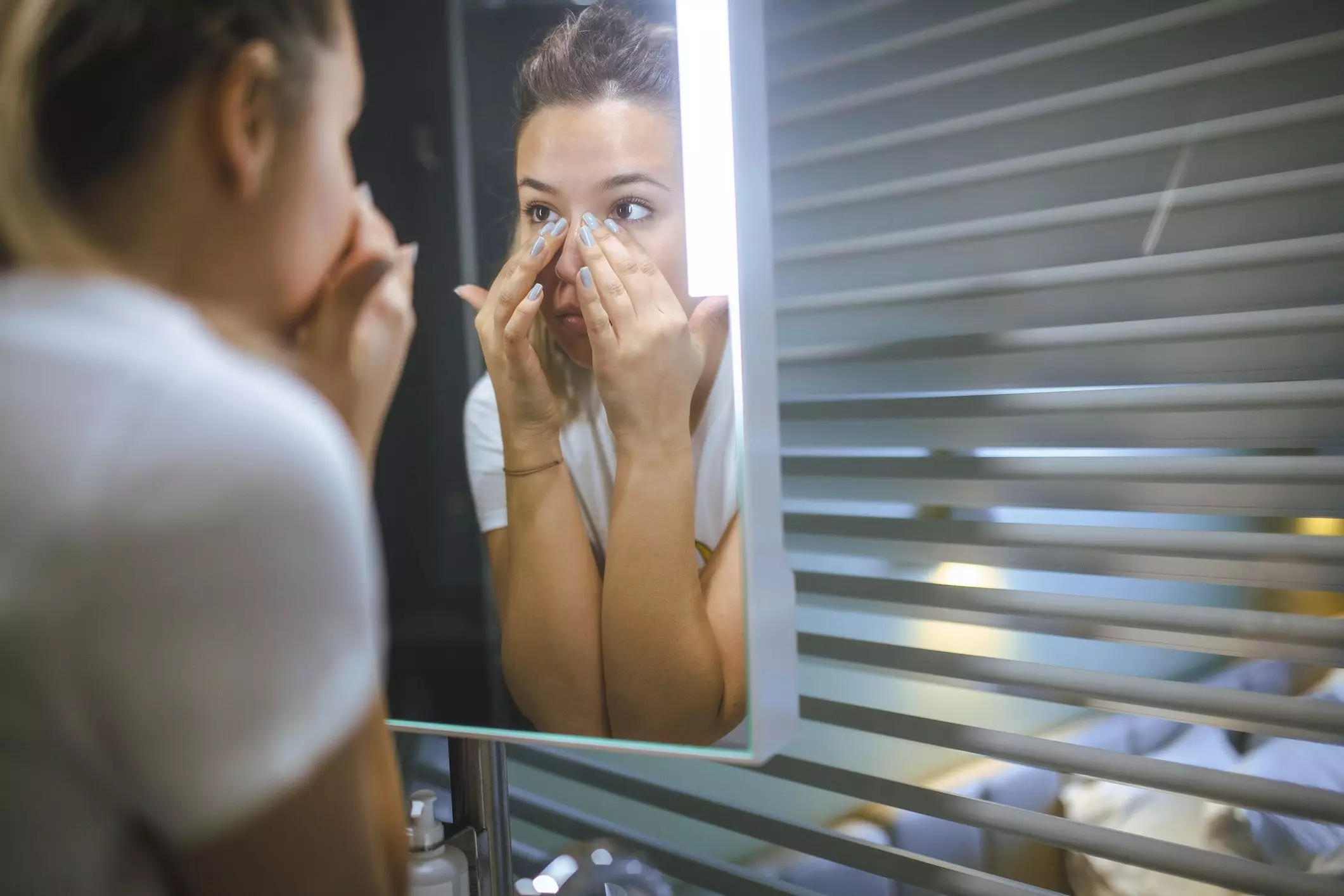 purple dark circles kung bakit sila lumilitaw at kung paano maalis ang mga ito