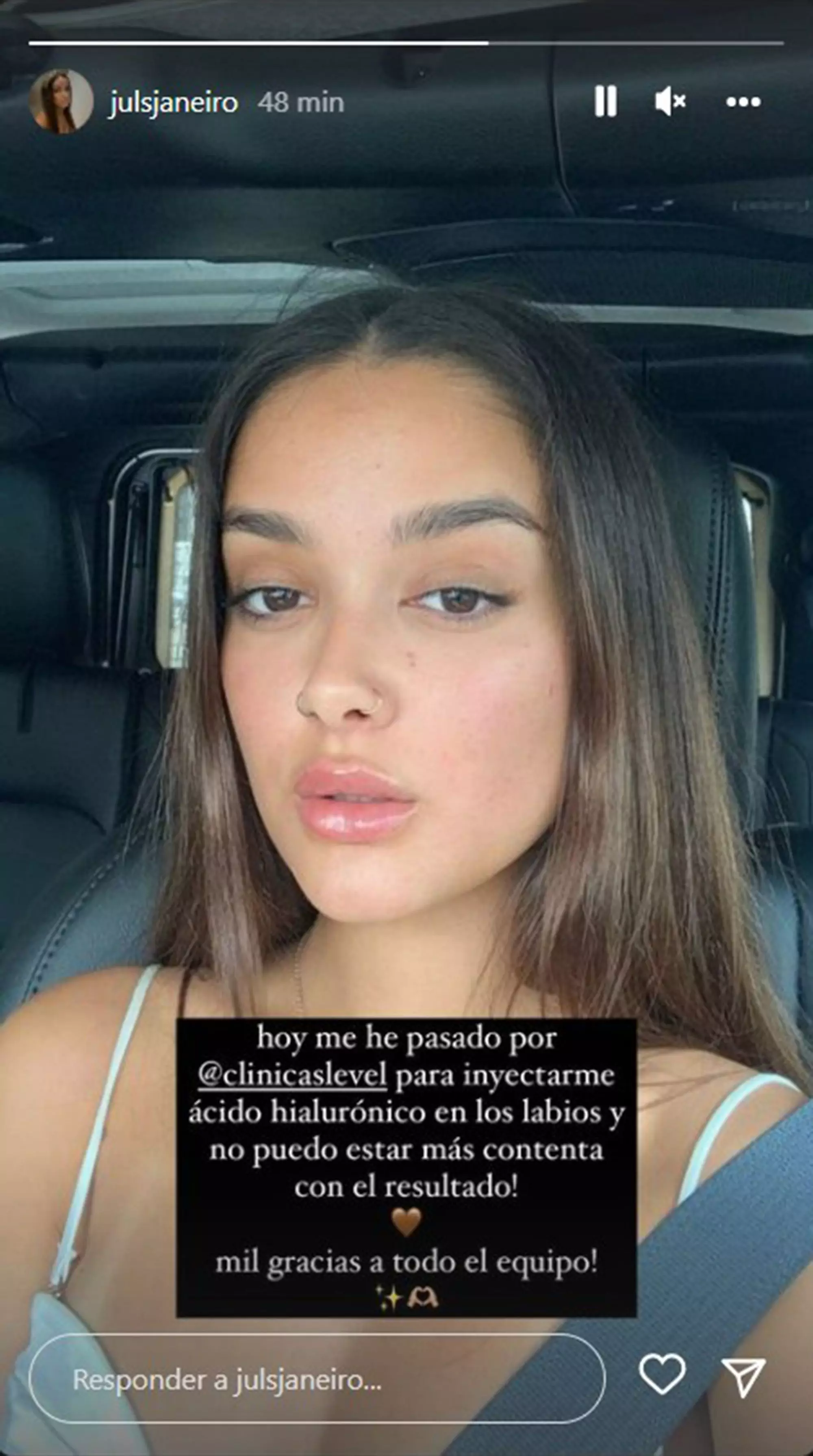 julia janeiro posa no instagram com seus novos lábios após retoque estético