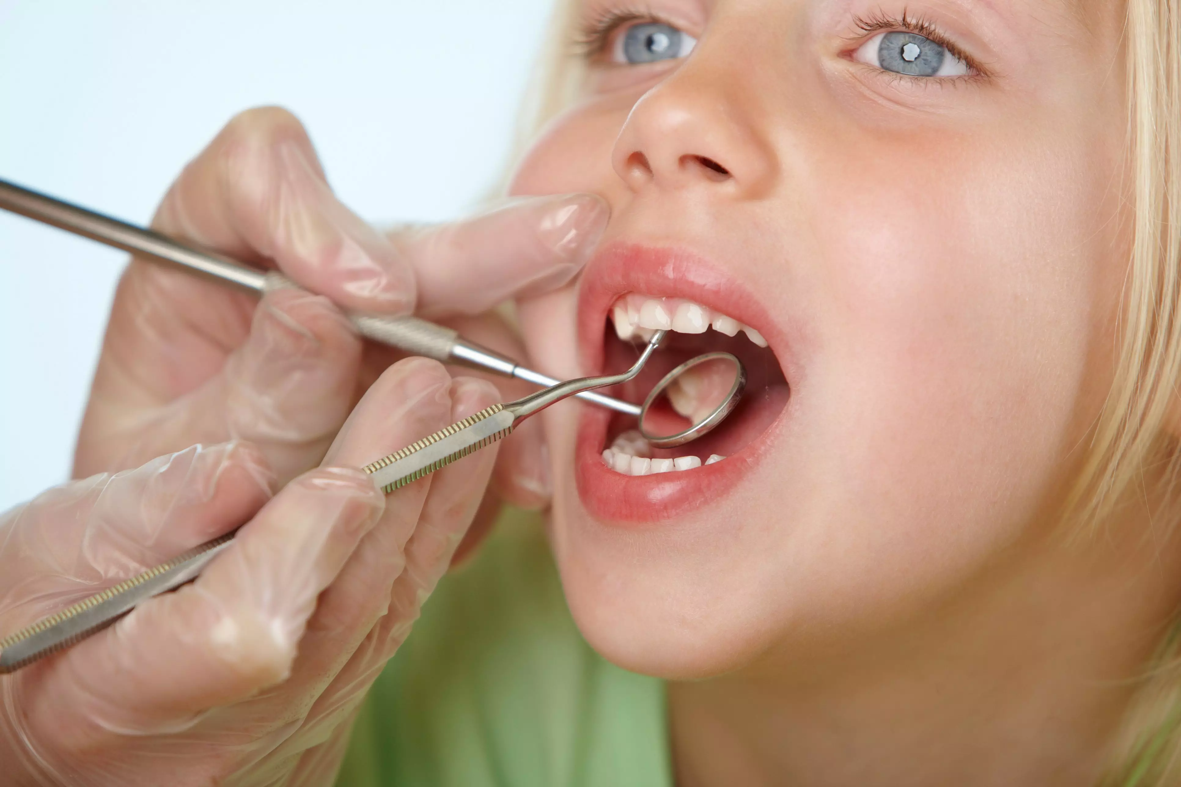 bruxismo de ranger de dentes em crianças